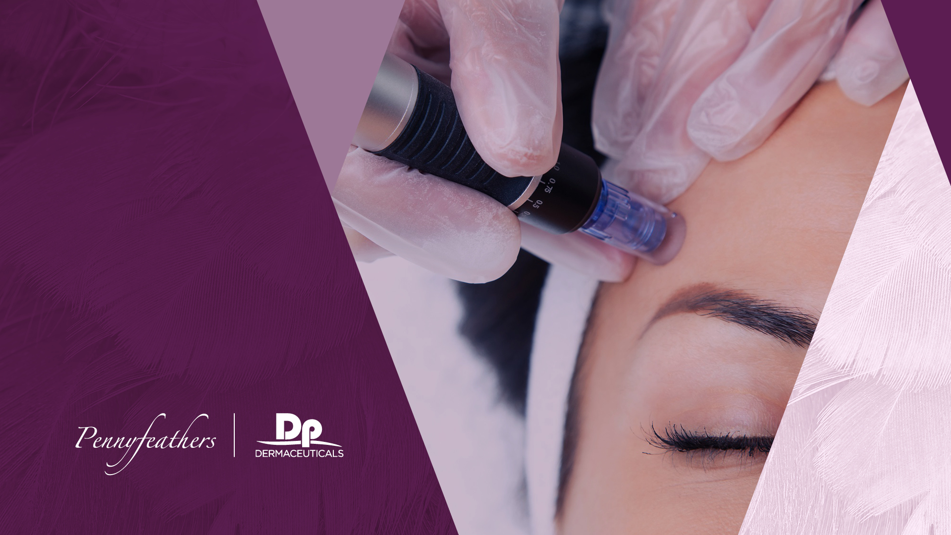 DermaPen Micro Needling Facials